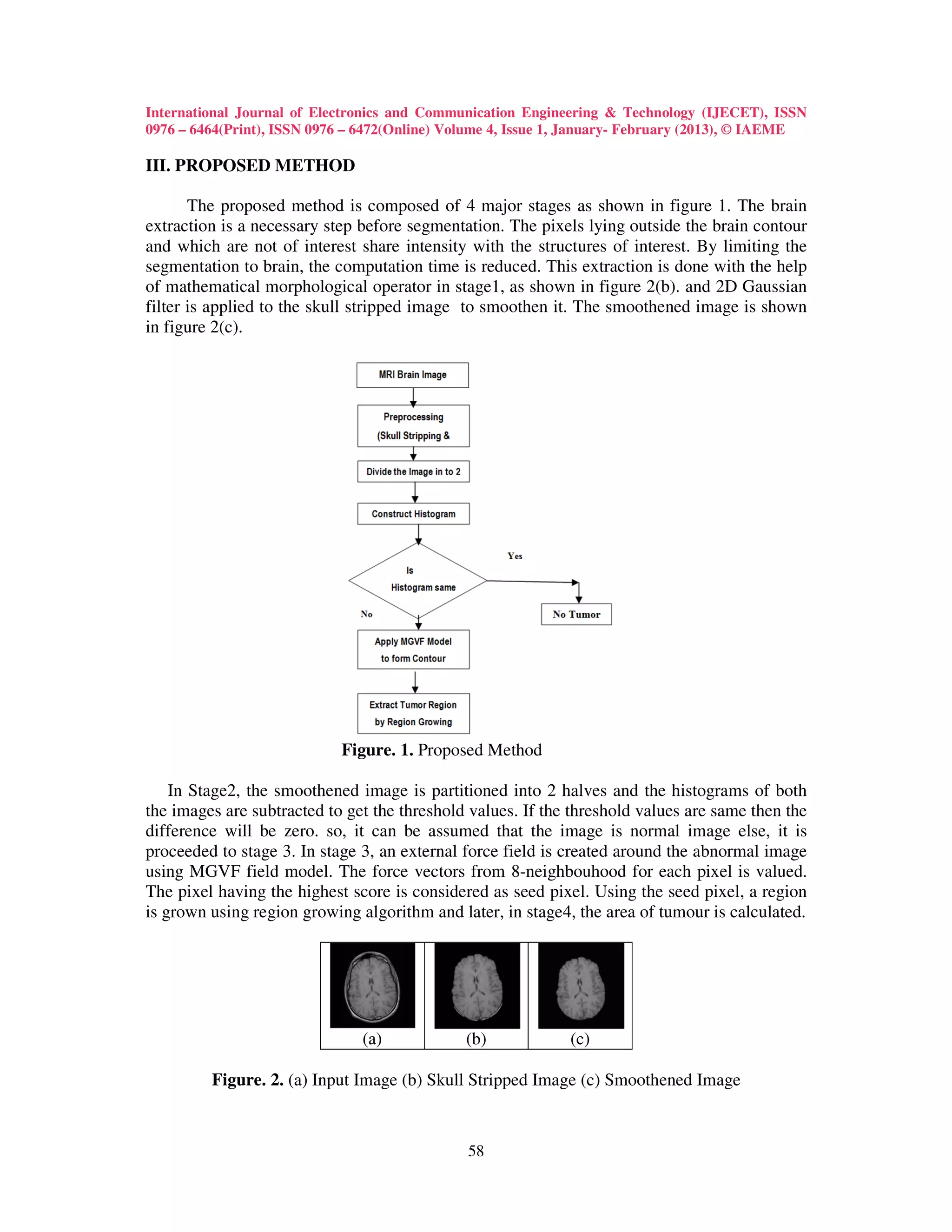 Mri Brain Tumour Detection By Histogram And Segmentation Pdf