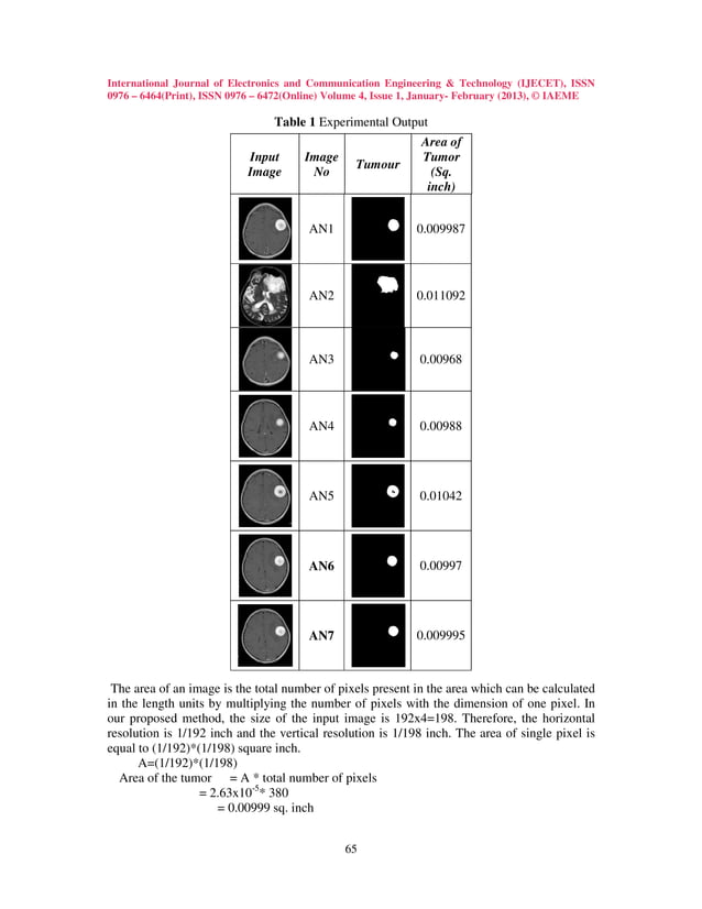 Mri brain tumour detection by histogram and segmentation | PDF