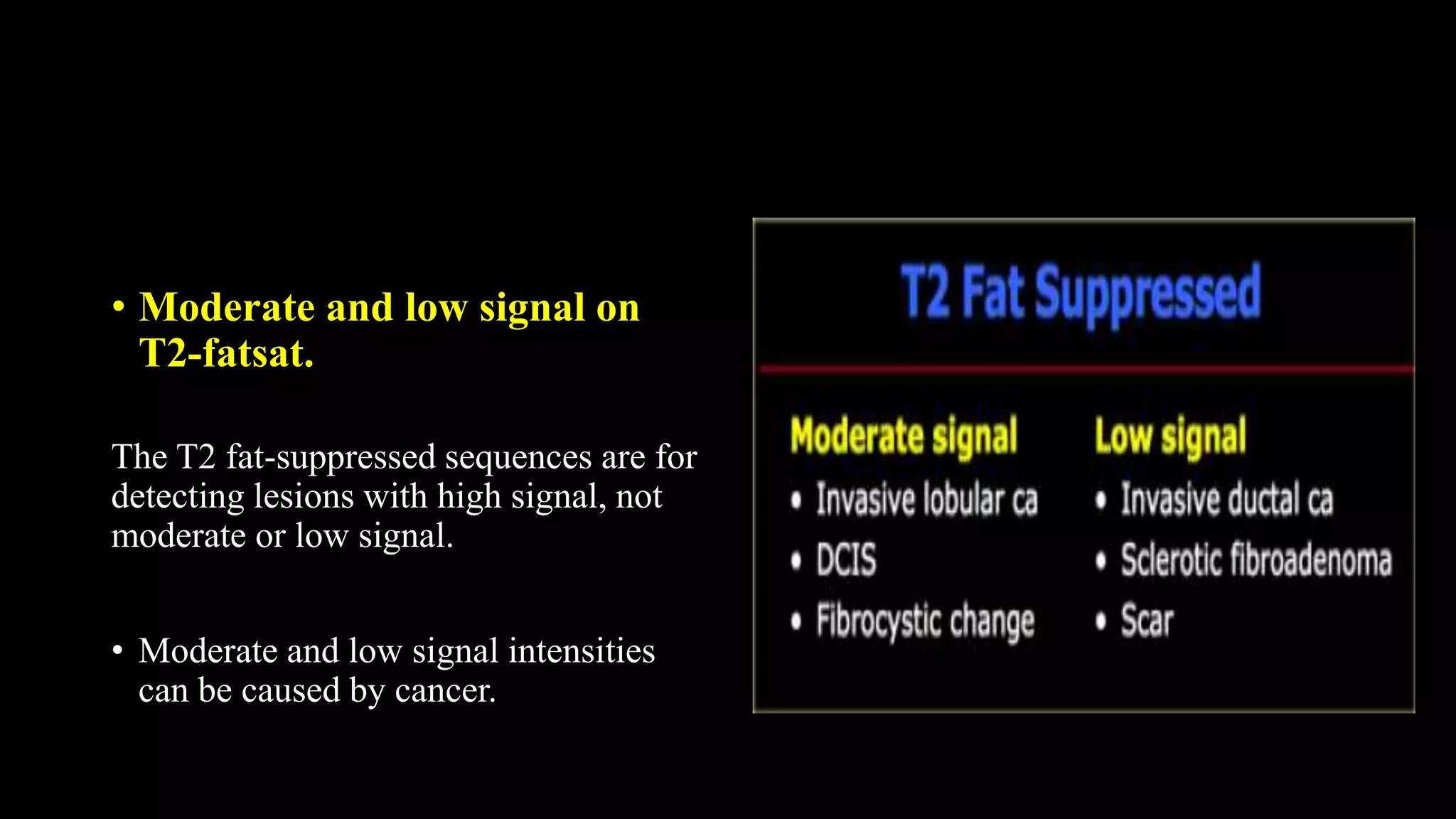 BREAST IMAGING MRI ppt DR ABHIJIT R SINGH | PPTX