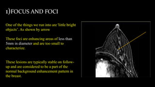 BREAST IMAGING MRI ppt DR ABHIJIT R SINGH | PPTX