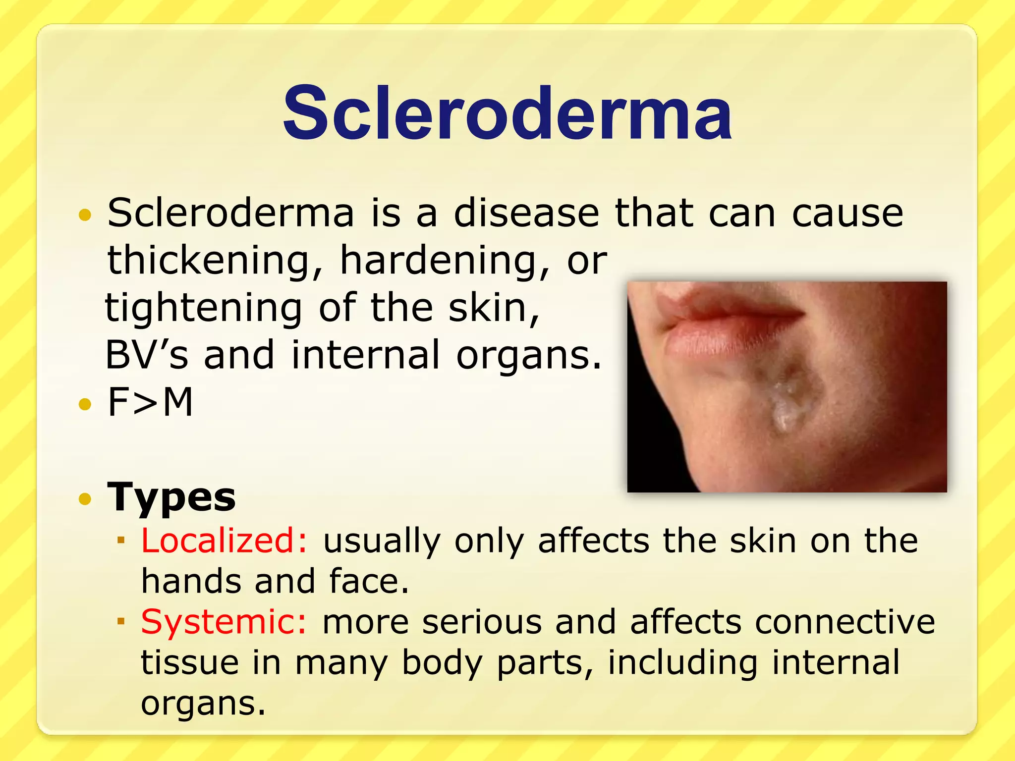 Mri case study- scleroderma | PPTX