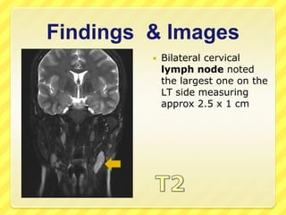 Mri case study- scleroderma | PPTX