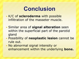 Mri case study- scleroderma | PPTX