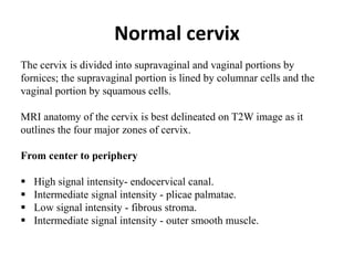 MRI carcinoma Uterus and Cervix | PPTX