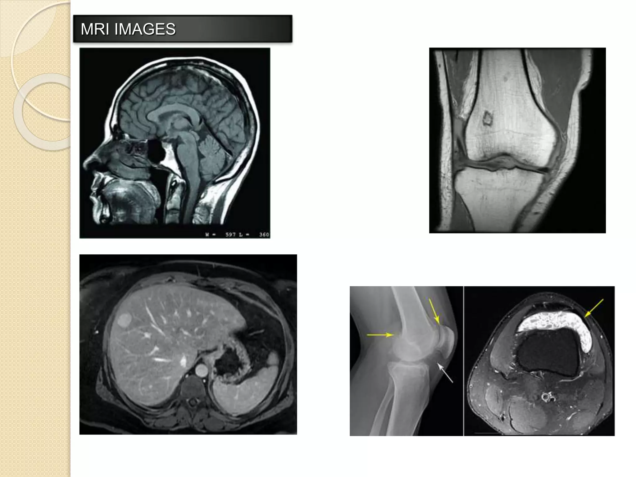 Mri components | PPTX