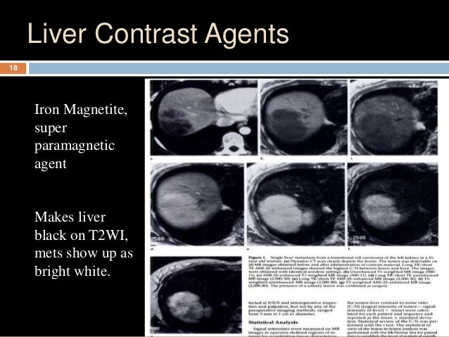 Mri contrast media