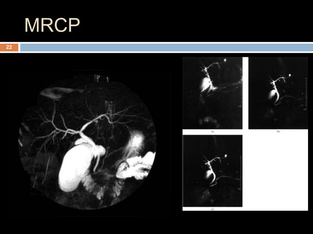 Mri contrast | PPT