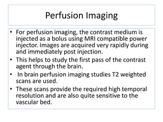 MRI CONTRAST AGENT.pdf