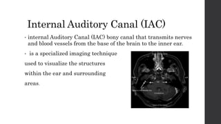 MRI Contrast And Plain.pptx