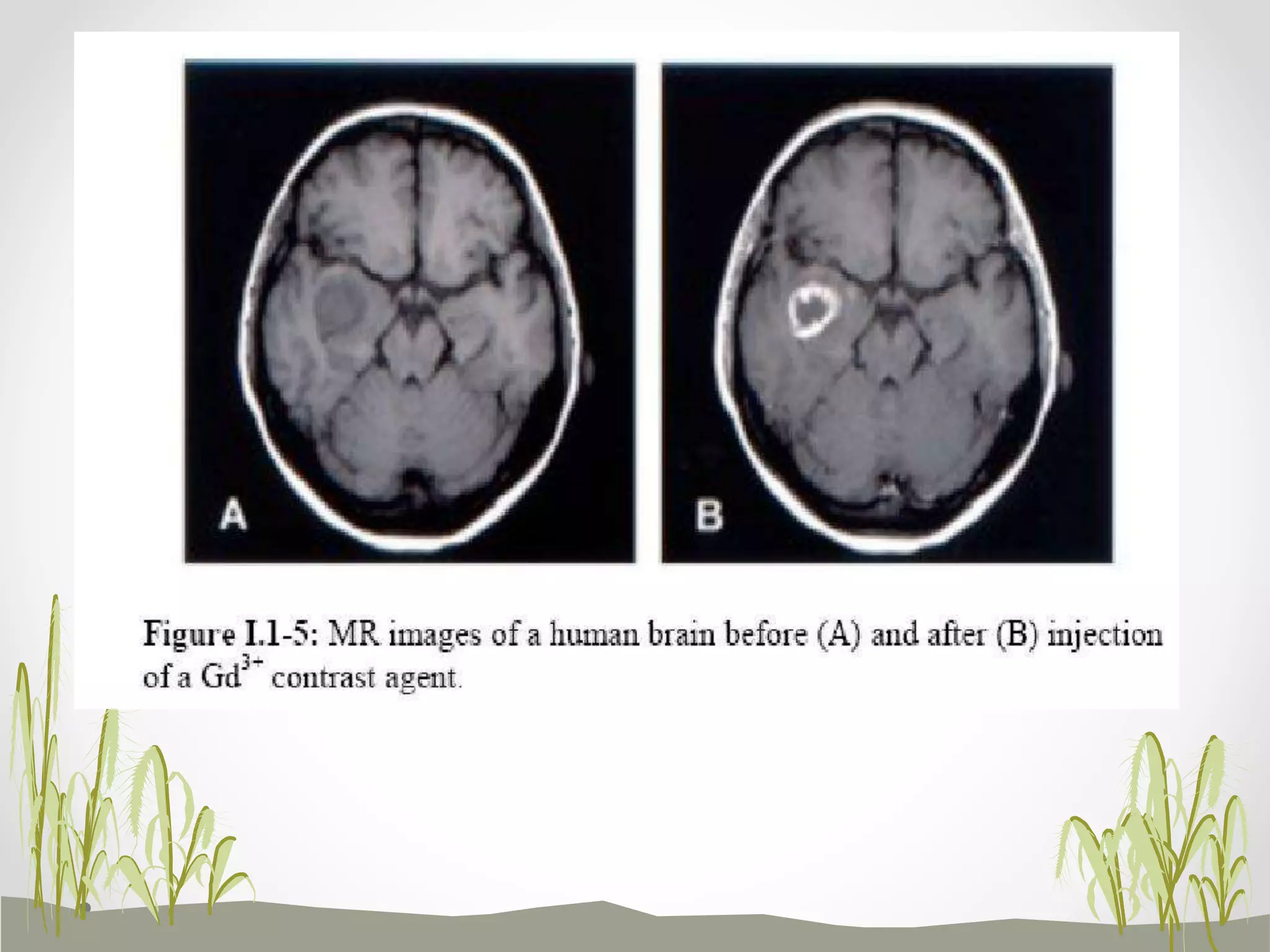 Mri contrasts ppt | PPTX