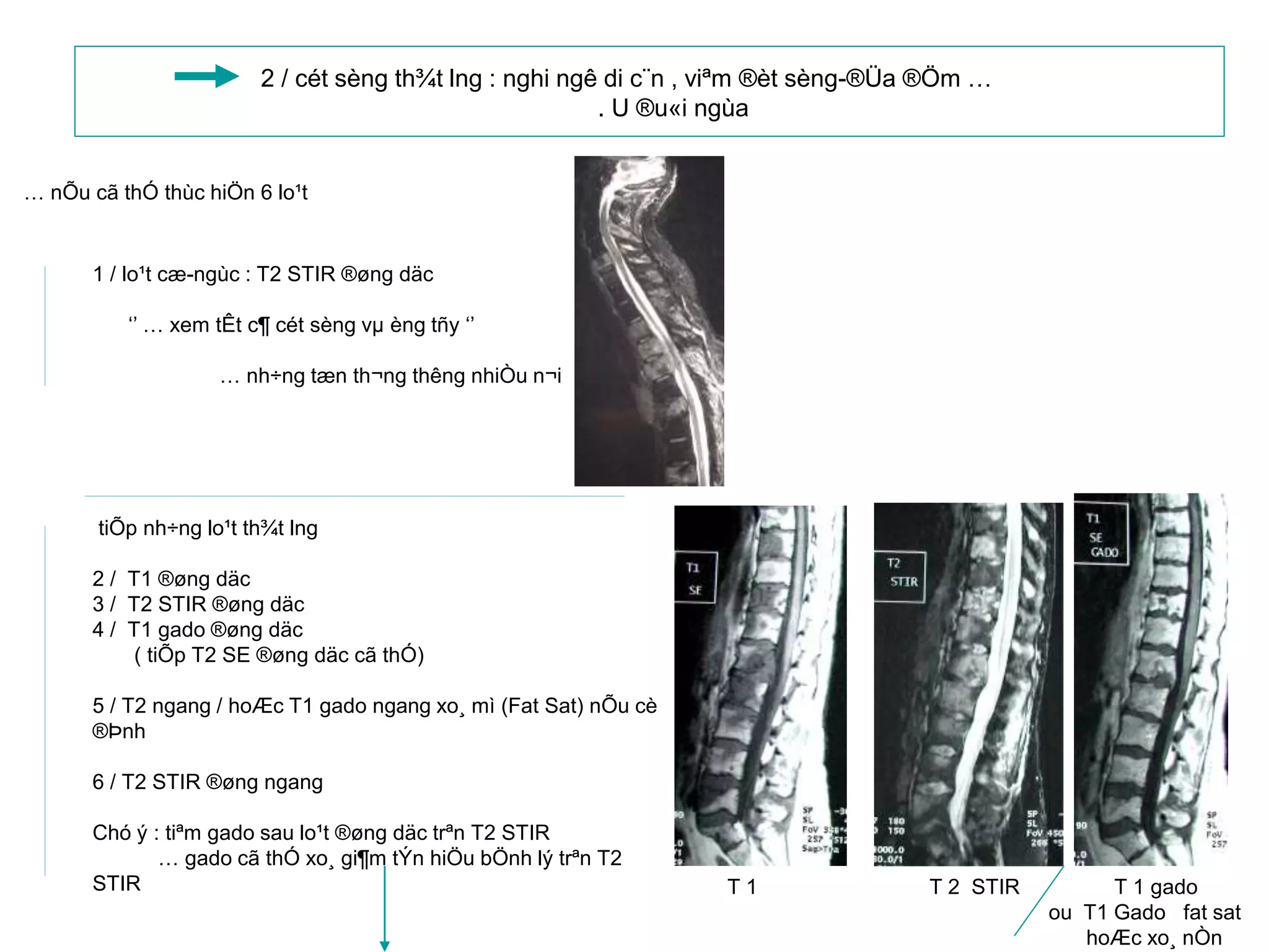 Mri cot song that lung 2(bacsihoasung.wordpress.com) | PPT