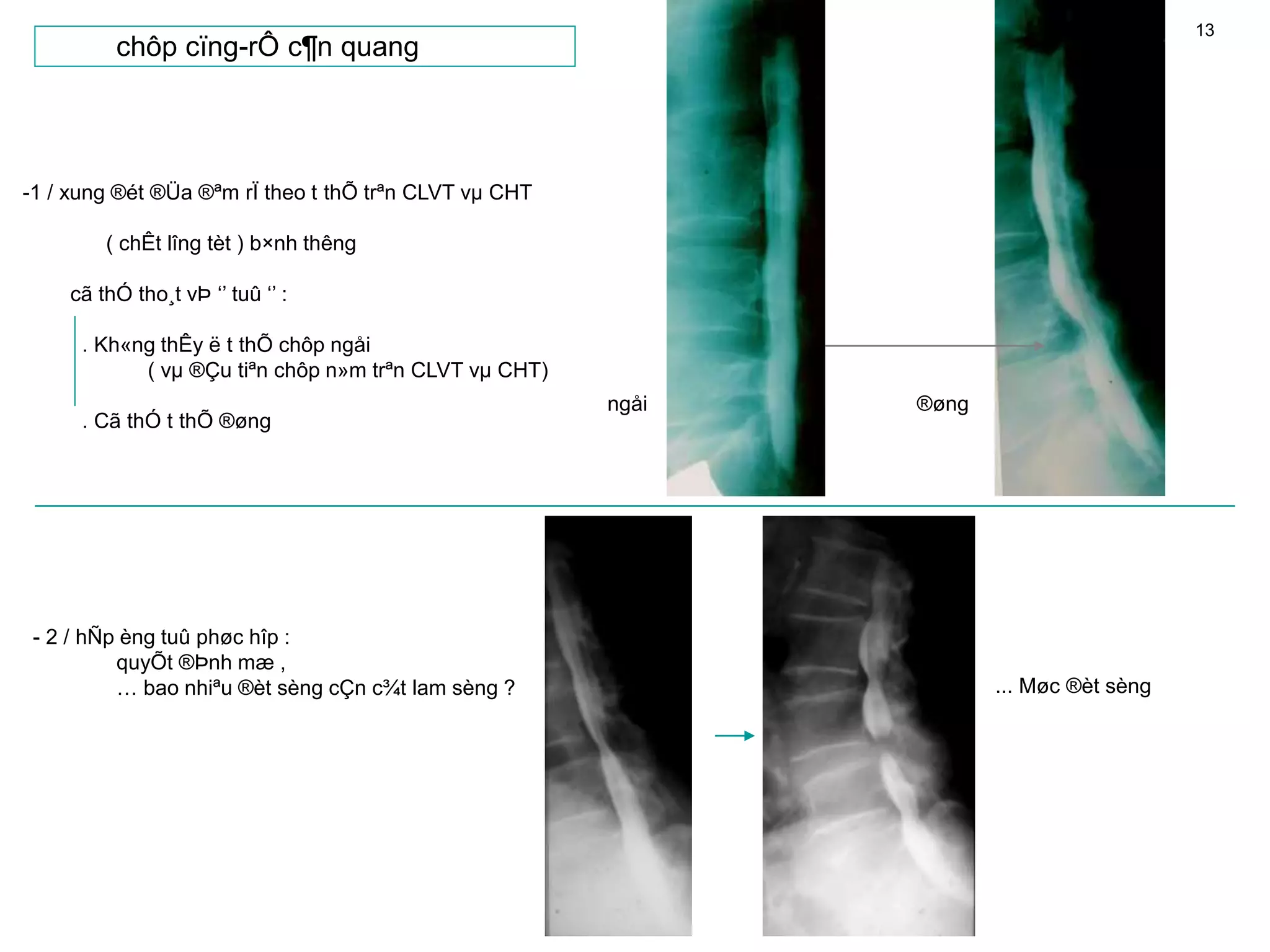Mri cot song that lung 2(bacsihoasung.wordpress.com) | PPT