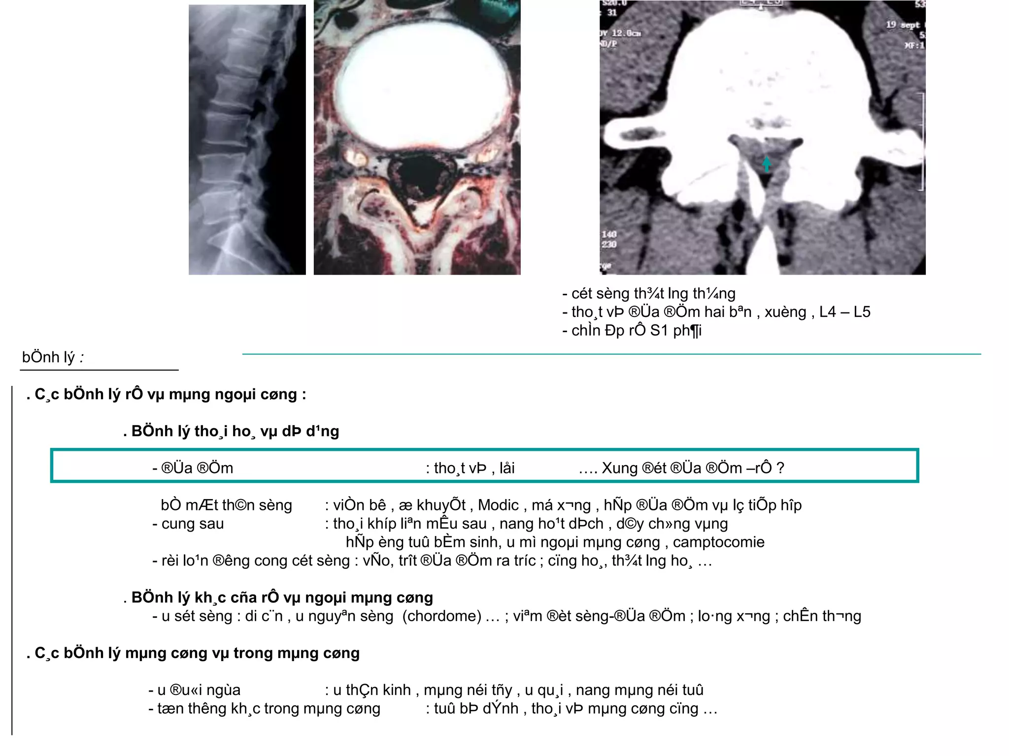 Mri cot song that lung 2(bacsihoasung.wordpress.com) | PPT