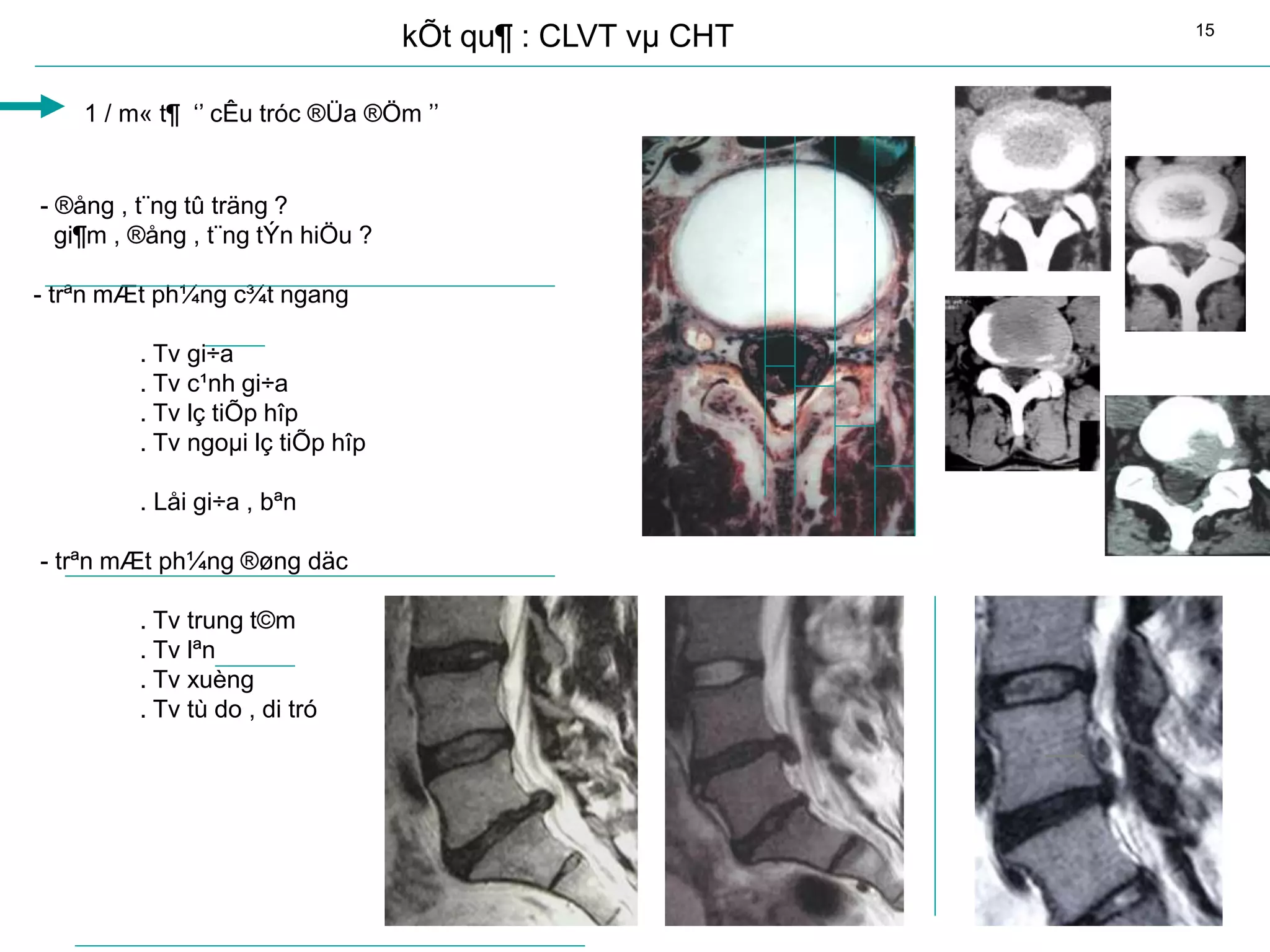 Mri cot song that lung 2(bacsihoasung.wordpress.com) | PPT