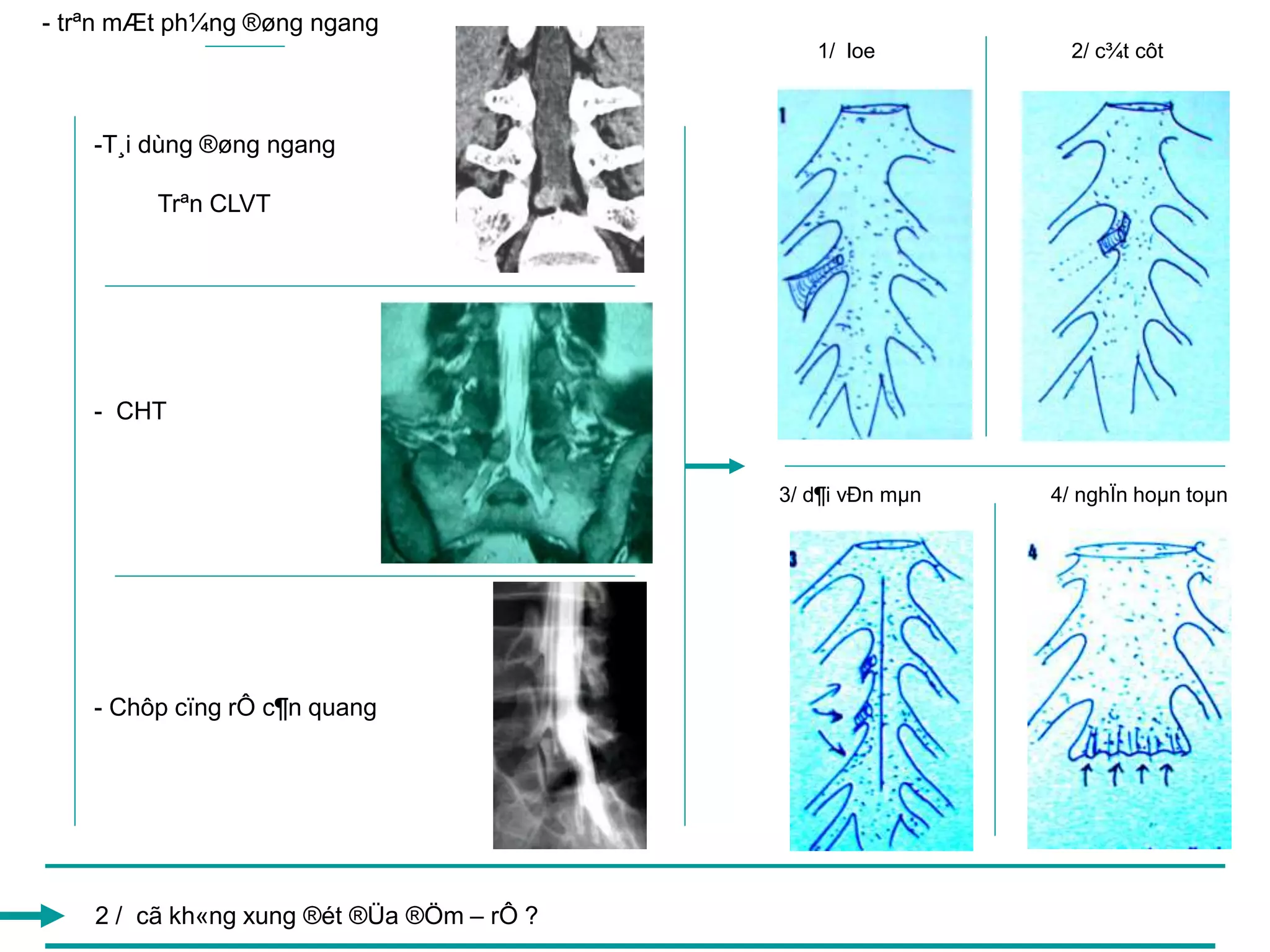 Mri cot song that lung 2(bacsihoasung.wordpress.com) | PPT