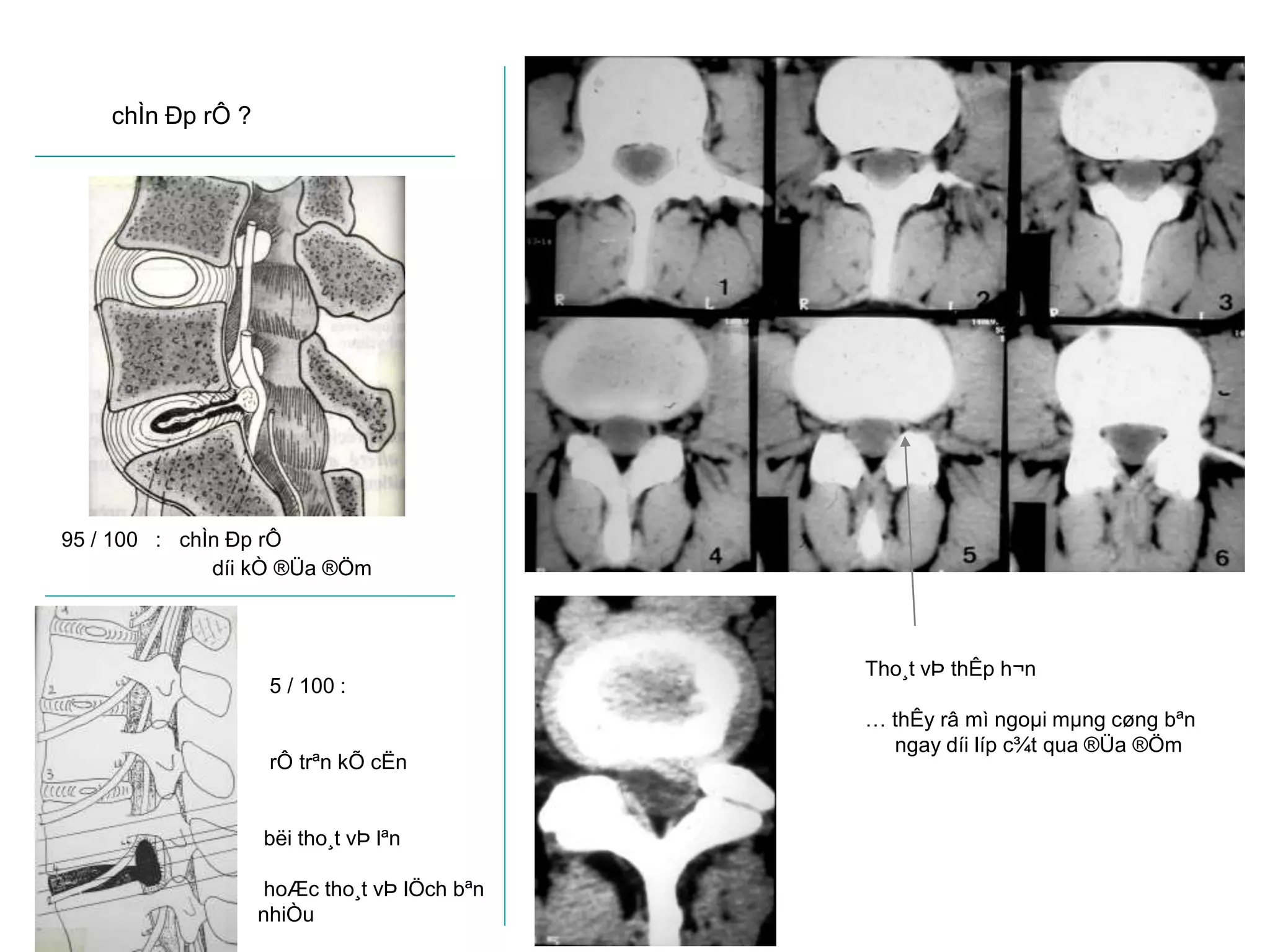 Mri cot song that lung 2(bacsihoasung.wordpress.com) | PPT
