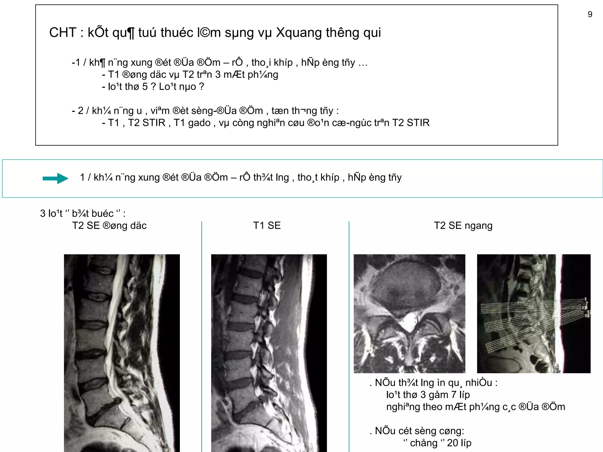 Mri cot song that lung 2(bacsihoasung.wordpress.com) | PPT