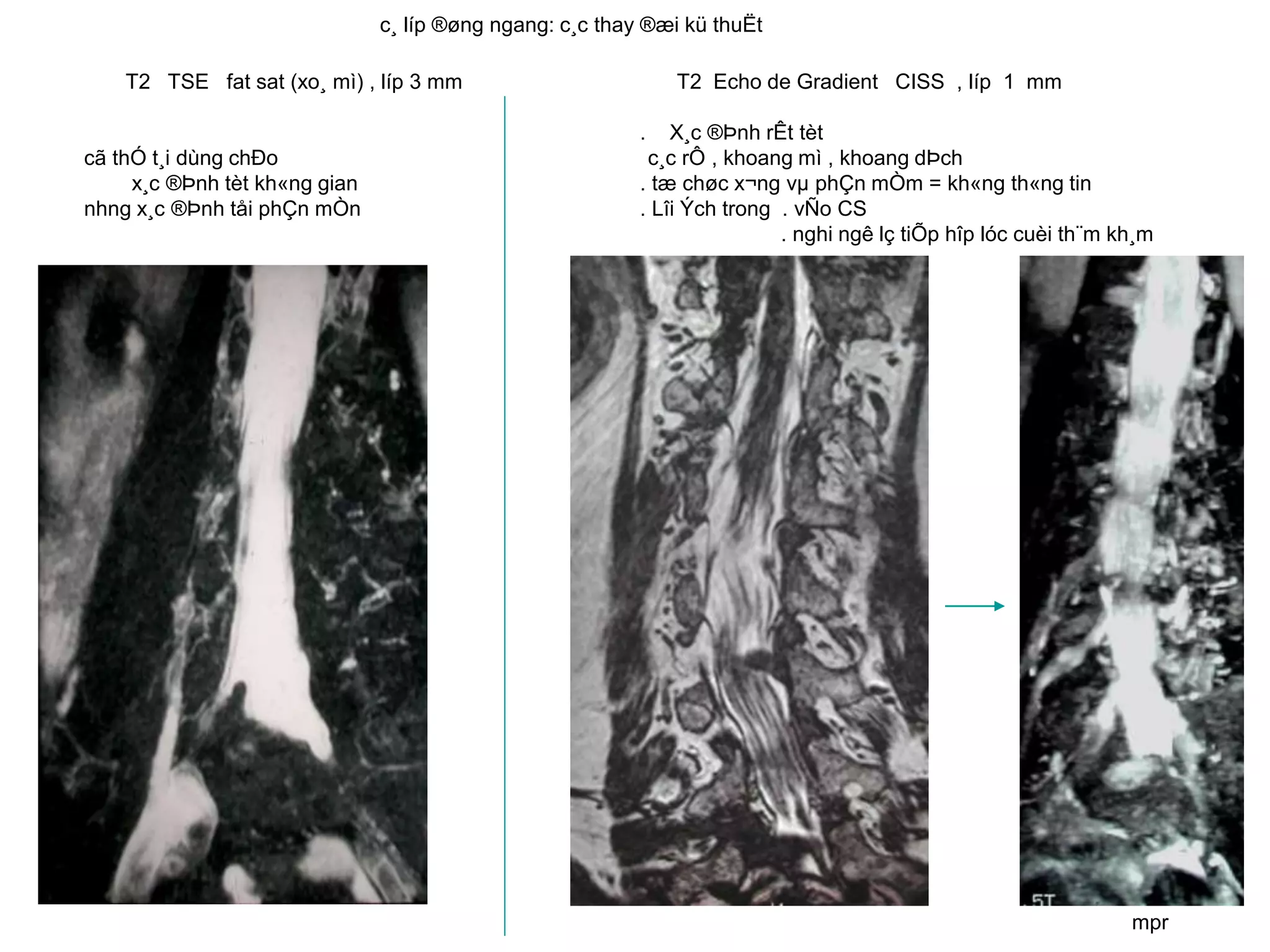 Mri cot song that lung 2(bacsihoasung.wordpress.com) | PPT