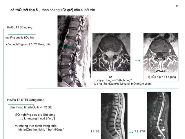 Mri cot song that lung 2(bacsihoasung.wordpress.com) | PPT