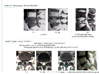 Mri cot song that lung 2(bacsihoasung.wordpress.com) | PPT