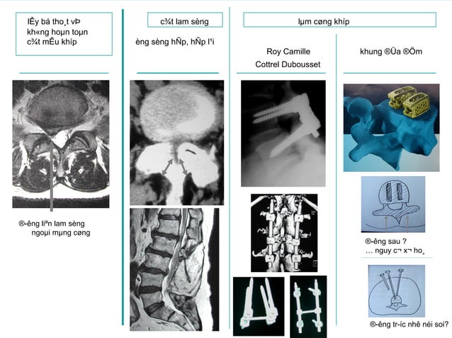 Mri cot song that lung 3(bacsihoasung.wordpress.com) | PPT
