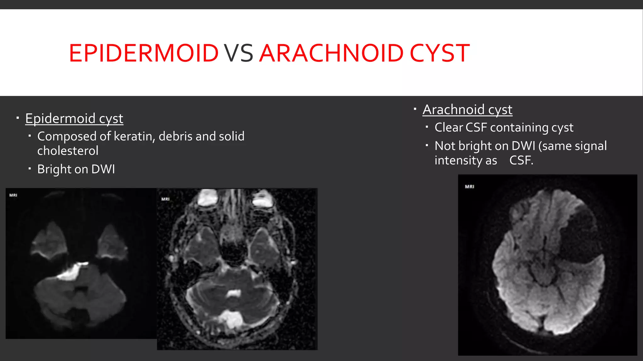mri diffusion .pptx