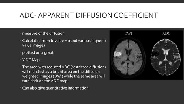 mri diffusion .pptx | Chemistry | Science