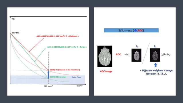 Mri Diffusion Pptx