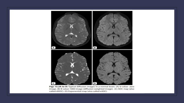 mri diffusion .pptx | Chemistry | Science