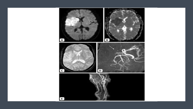mri diffusion .pptx | Chemistry | Science