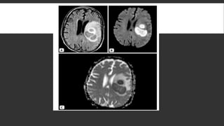 mri diffusion .pptx