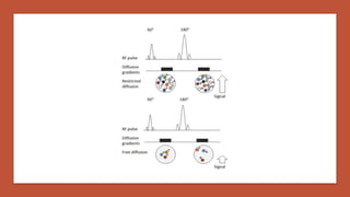 mri diffusion .pptx