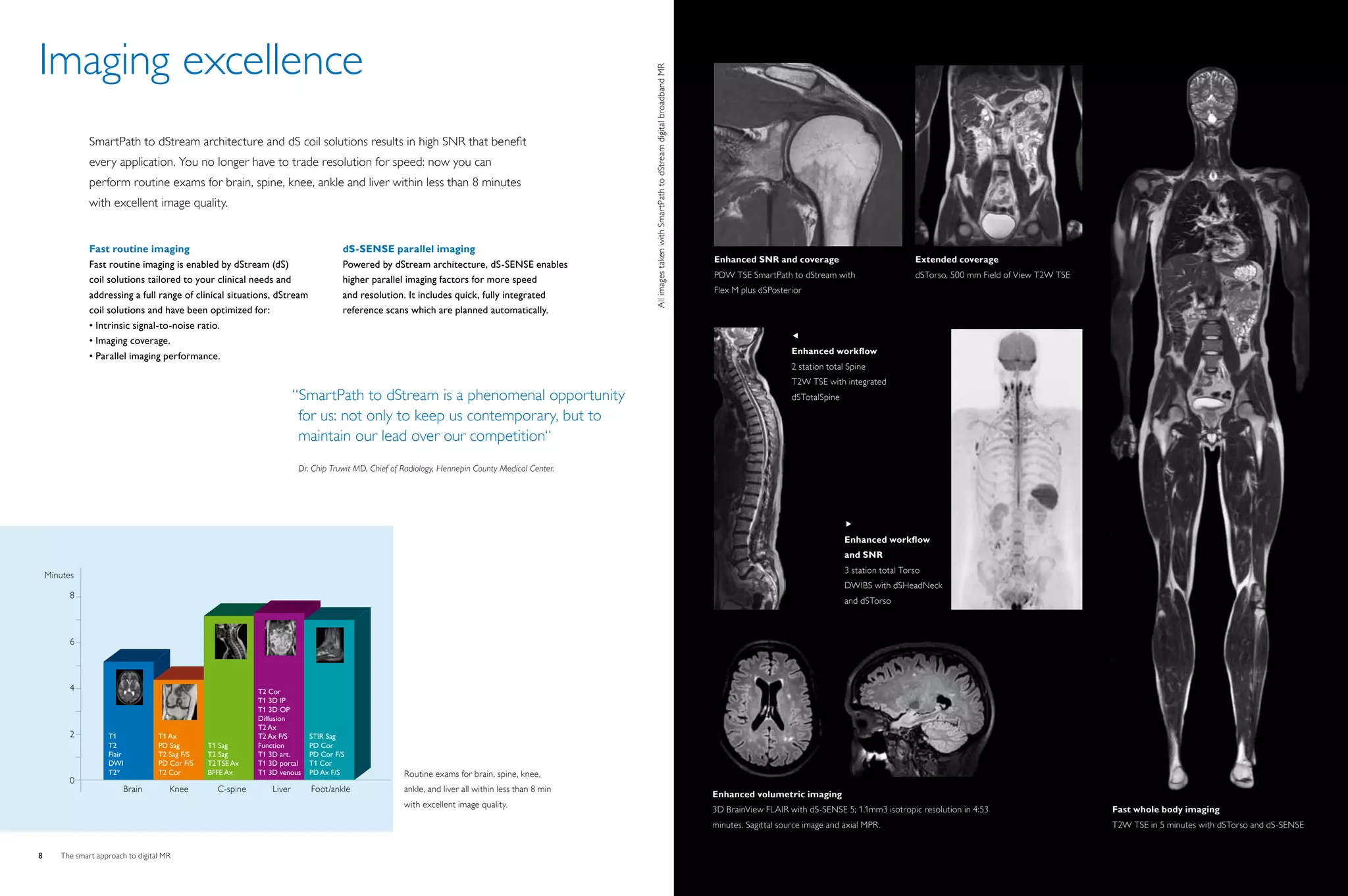 Mri d stream brochure_final_16 nov 12 | PDF