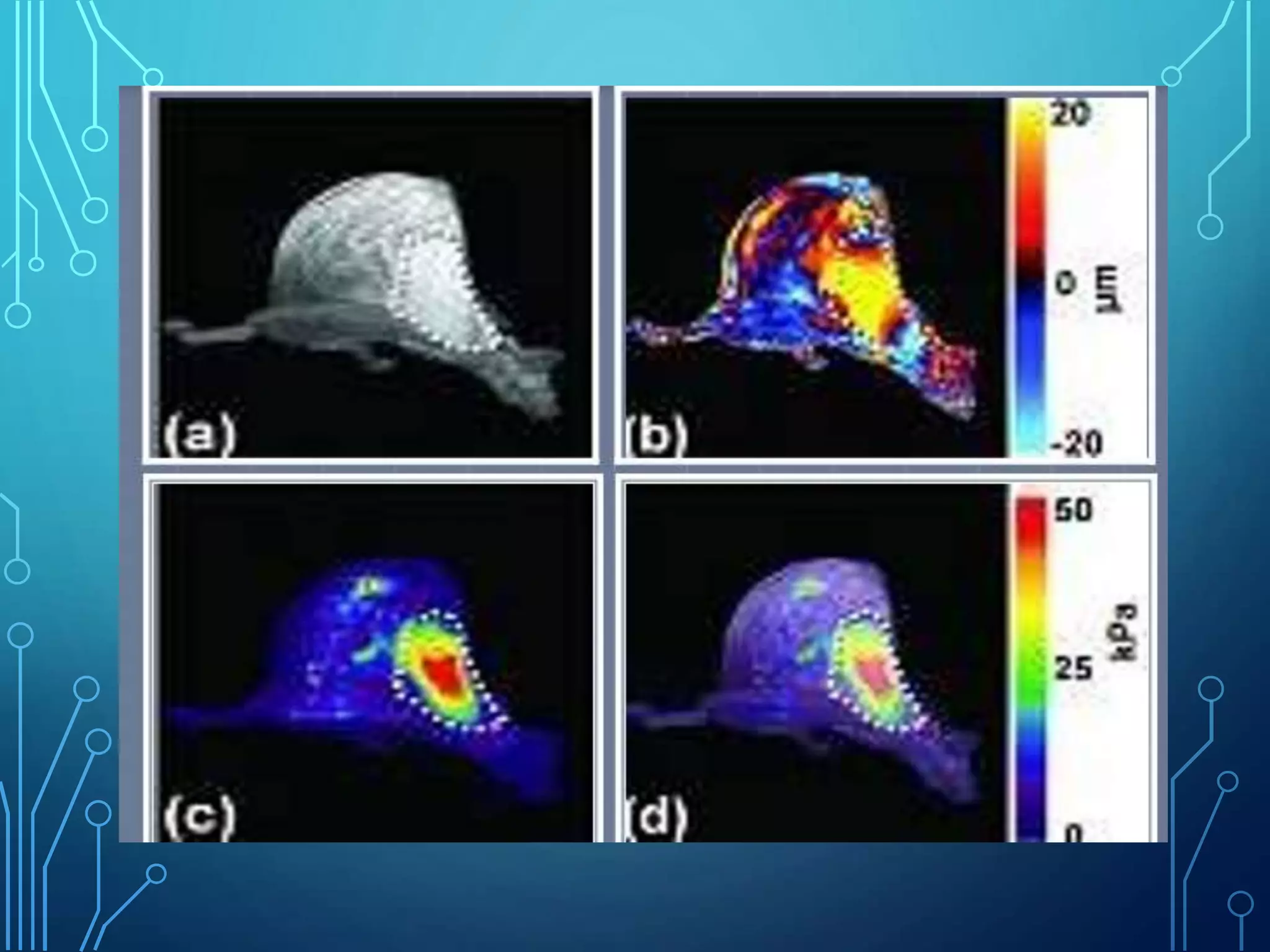 Mri elastography | PPTX