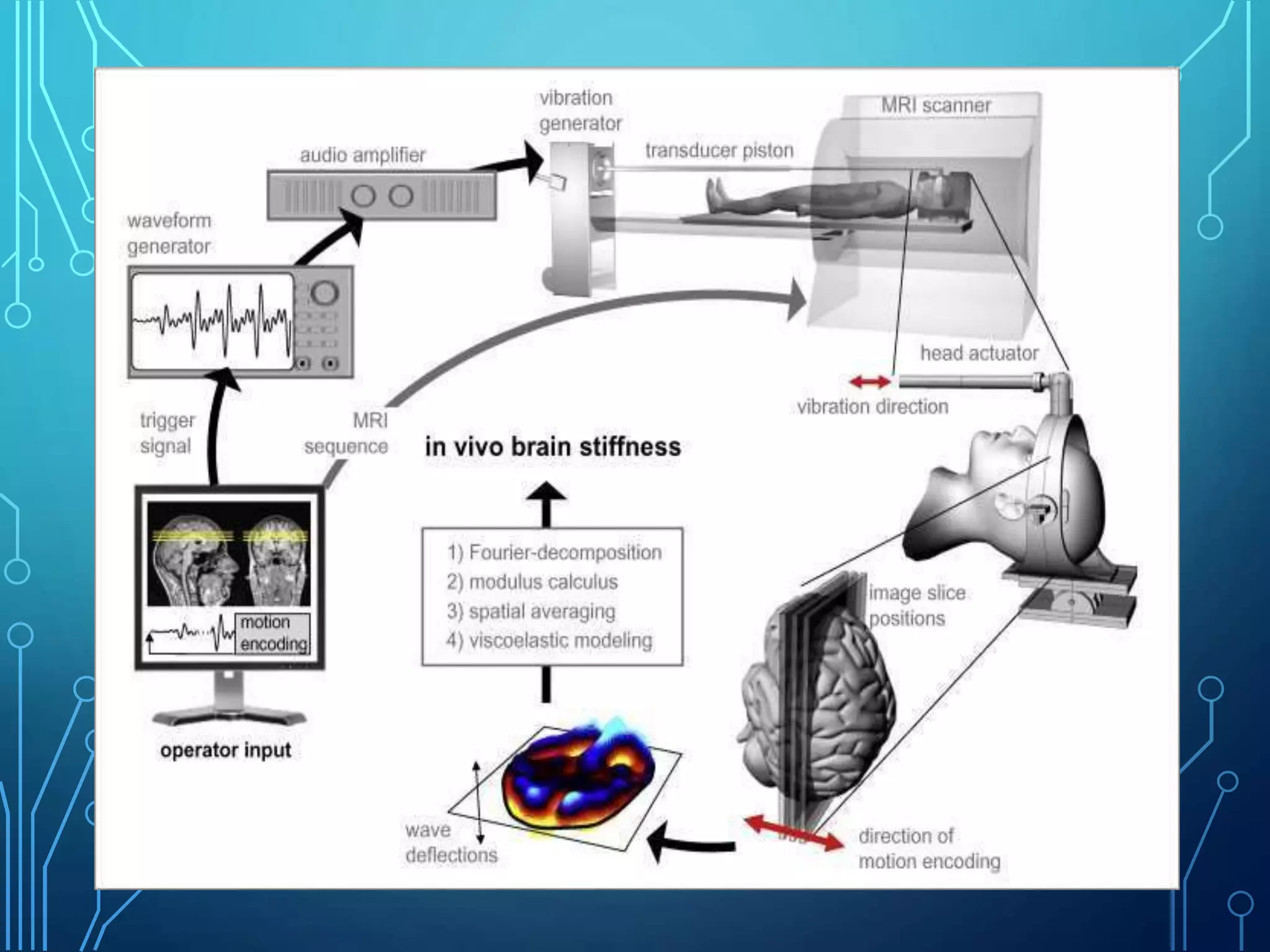 Mri elastography | PPTX