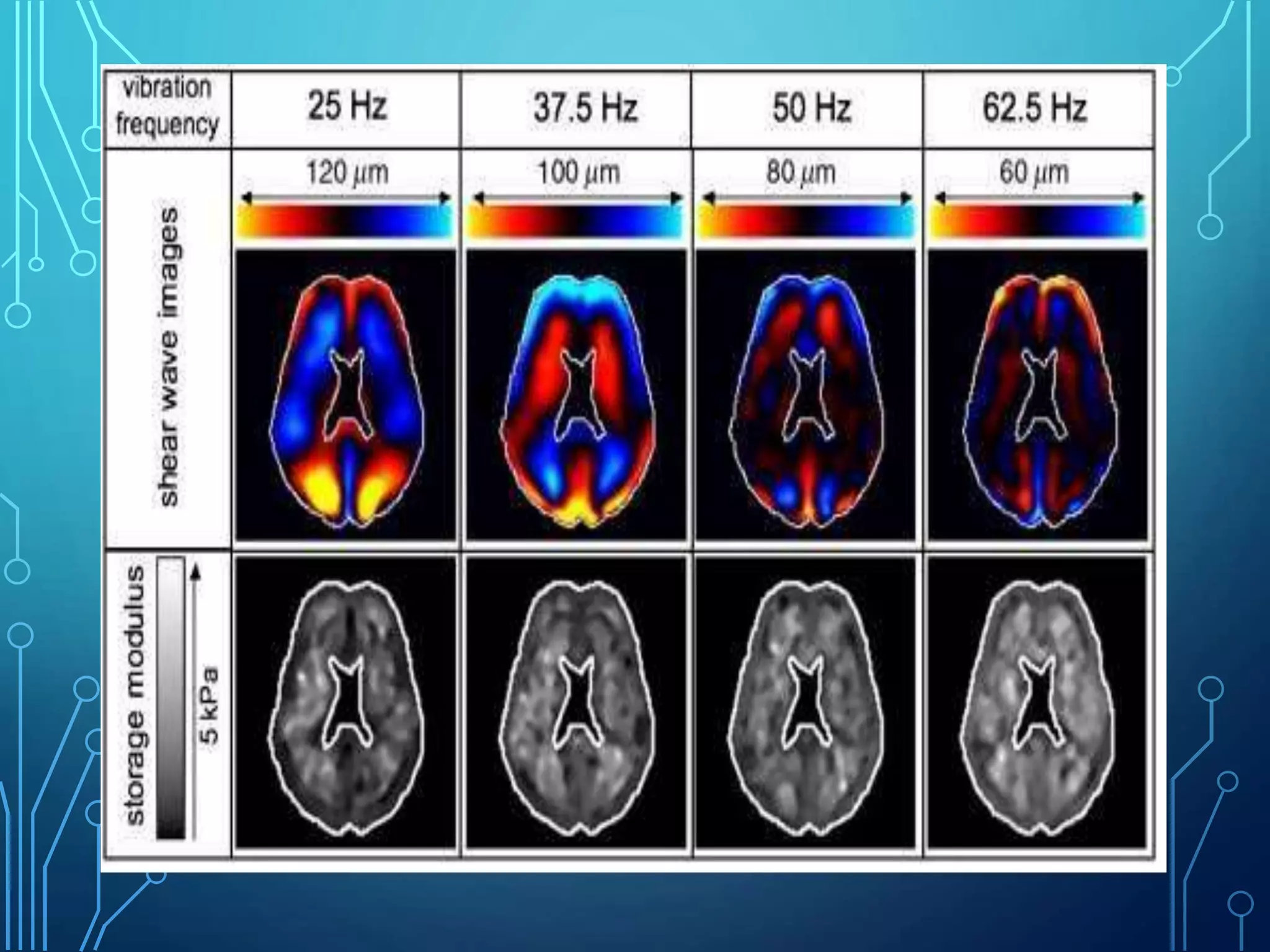 Mri elastography | PPTX