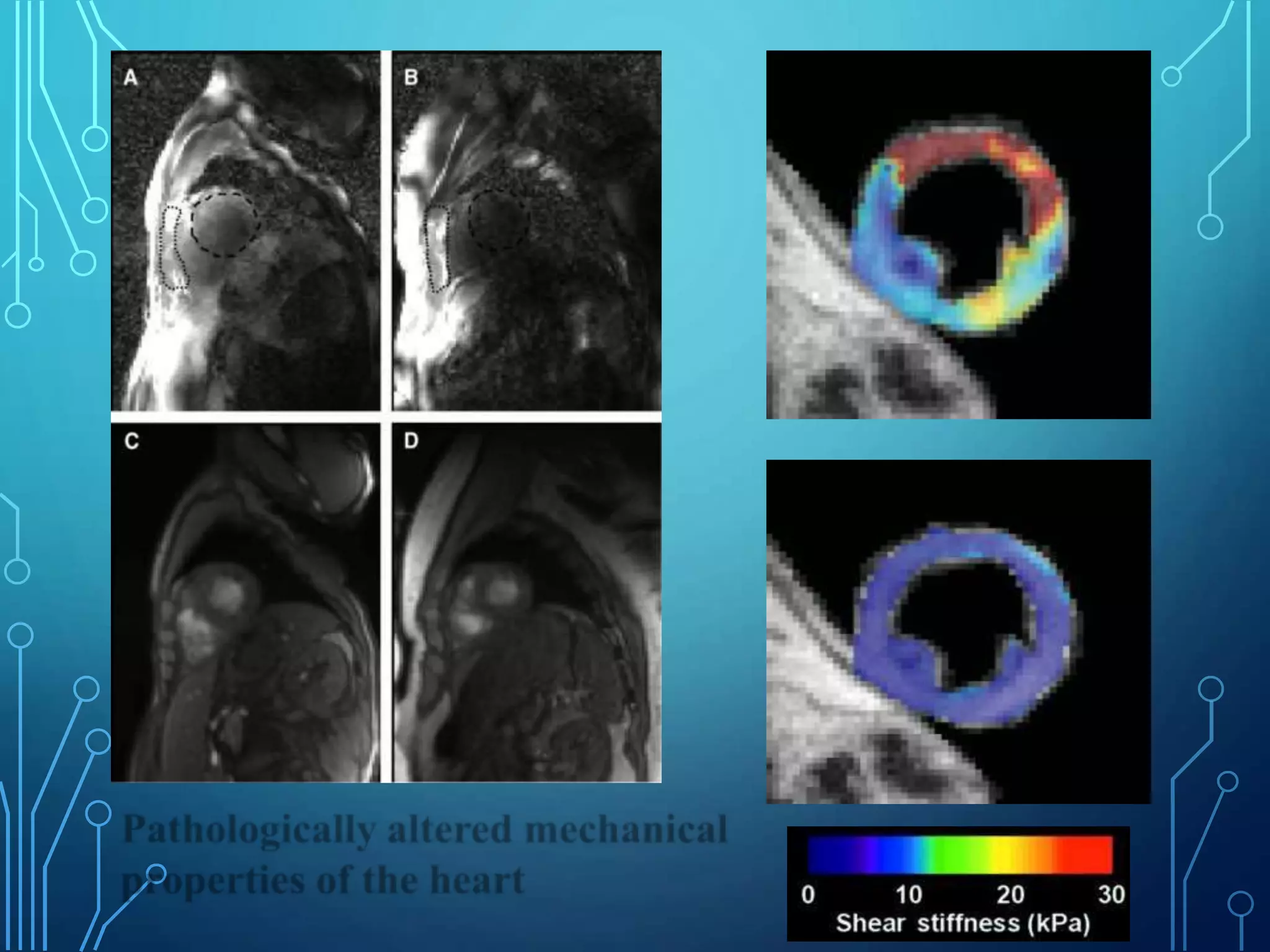 Mri elastography | PPTX