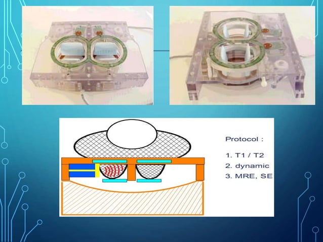Mri elastography | PPTX