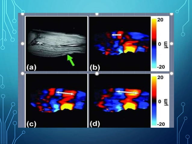 Mri elastography | PPTX