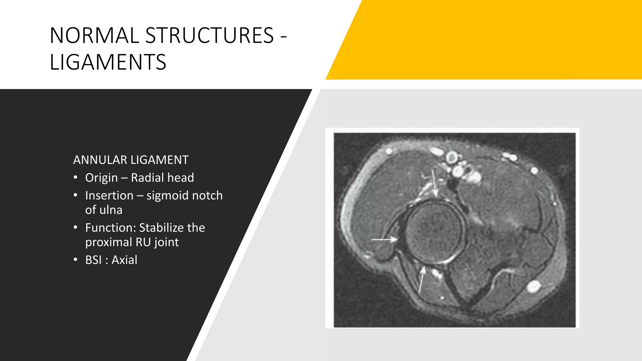 MR ANATOMY OF WRIST AND ELBOW RV | PPTX