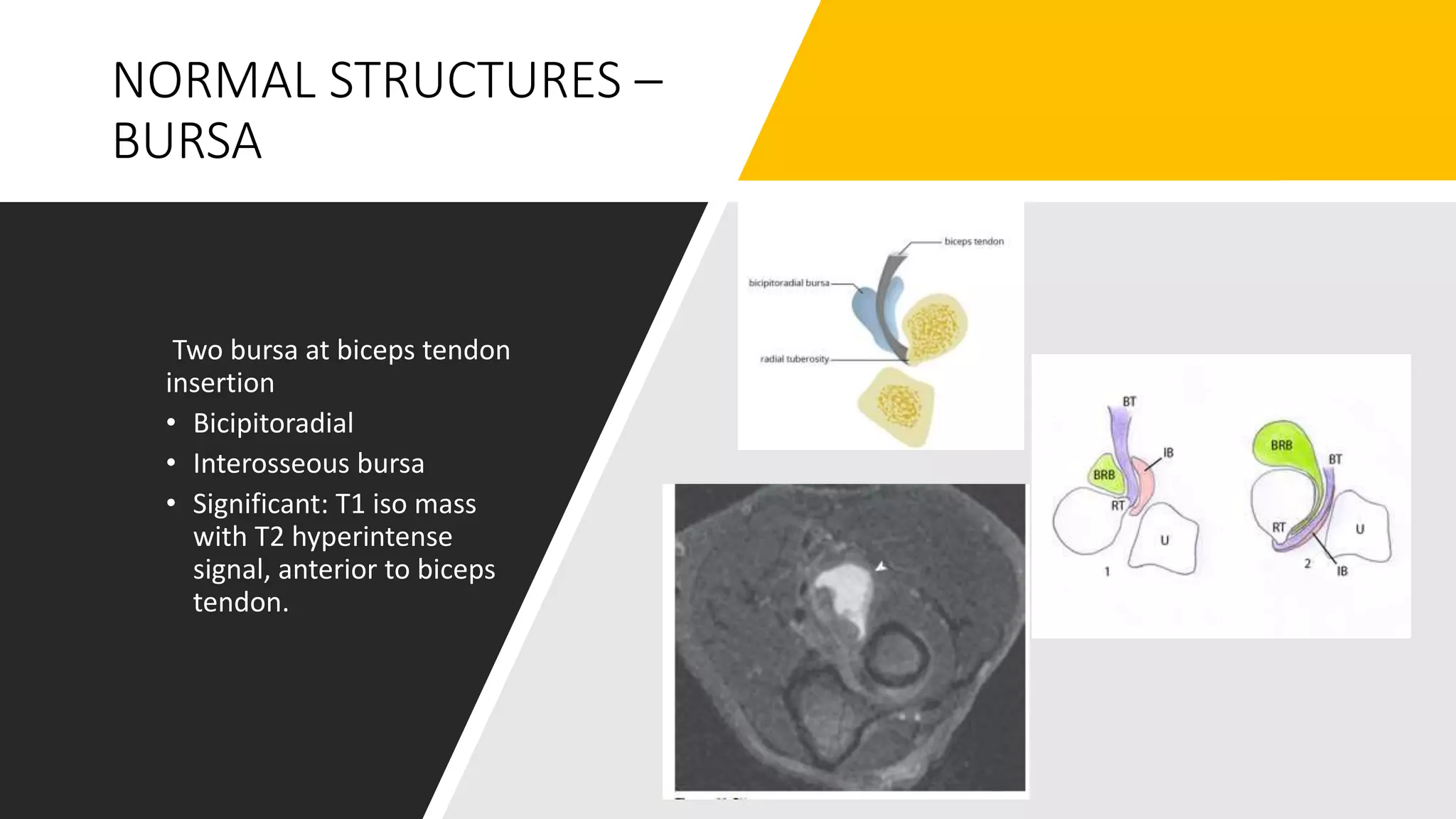 MR ANATOMY OF WRIST AND ELBOW RV | PPTX