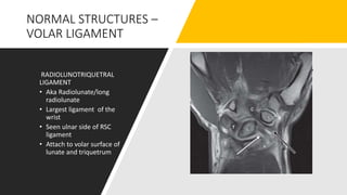 MR ANATOMY OF WRIST AND ELBOW RV | PPTX