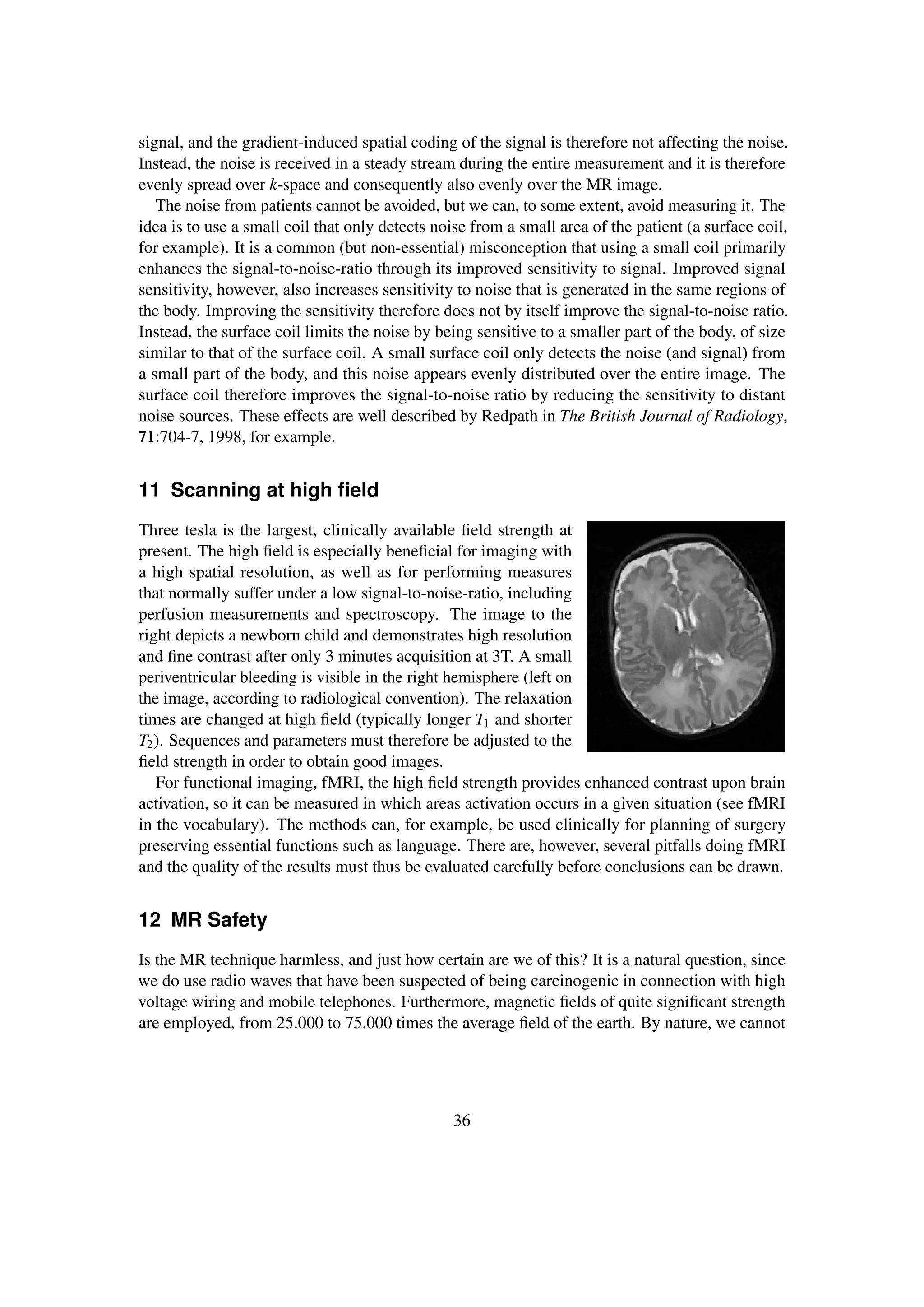 Mri english a4 | PDF