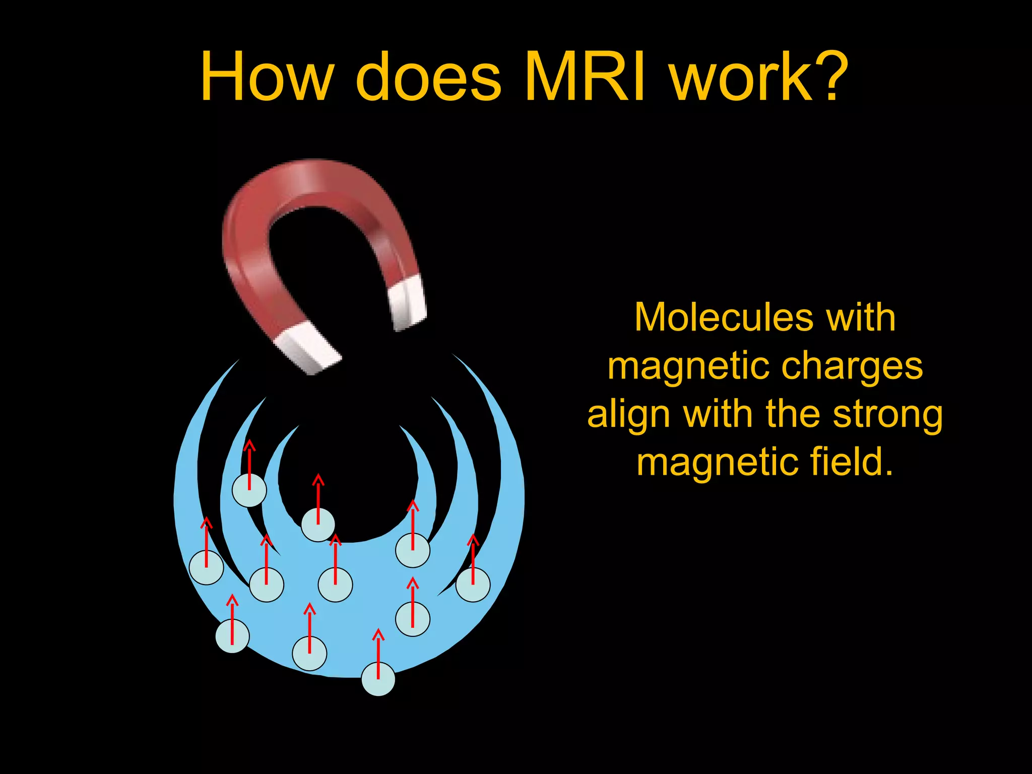 MRI explained | PPT