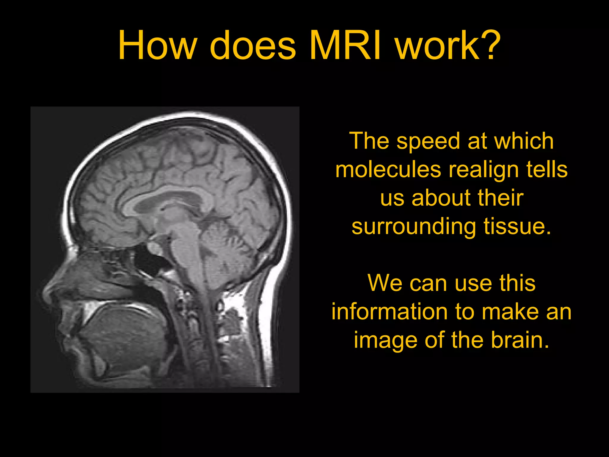 MRI explained | PPT