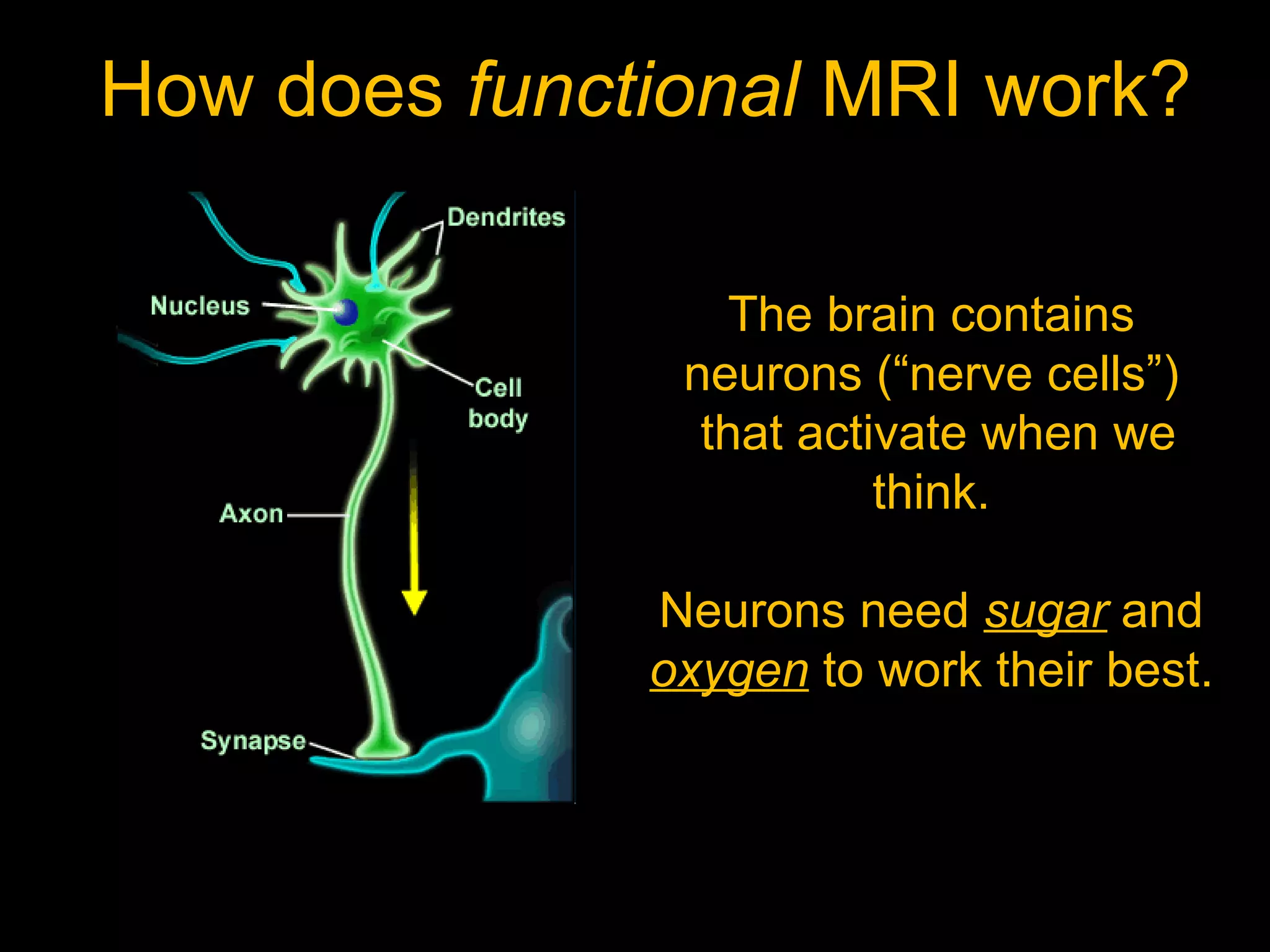 MRI explained | PPT