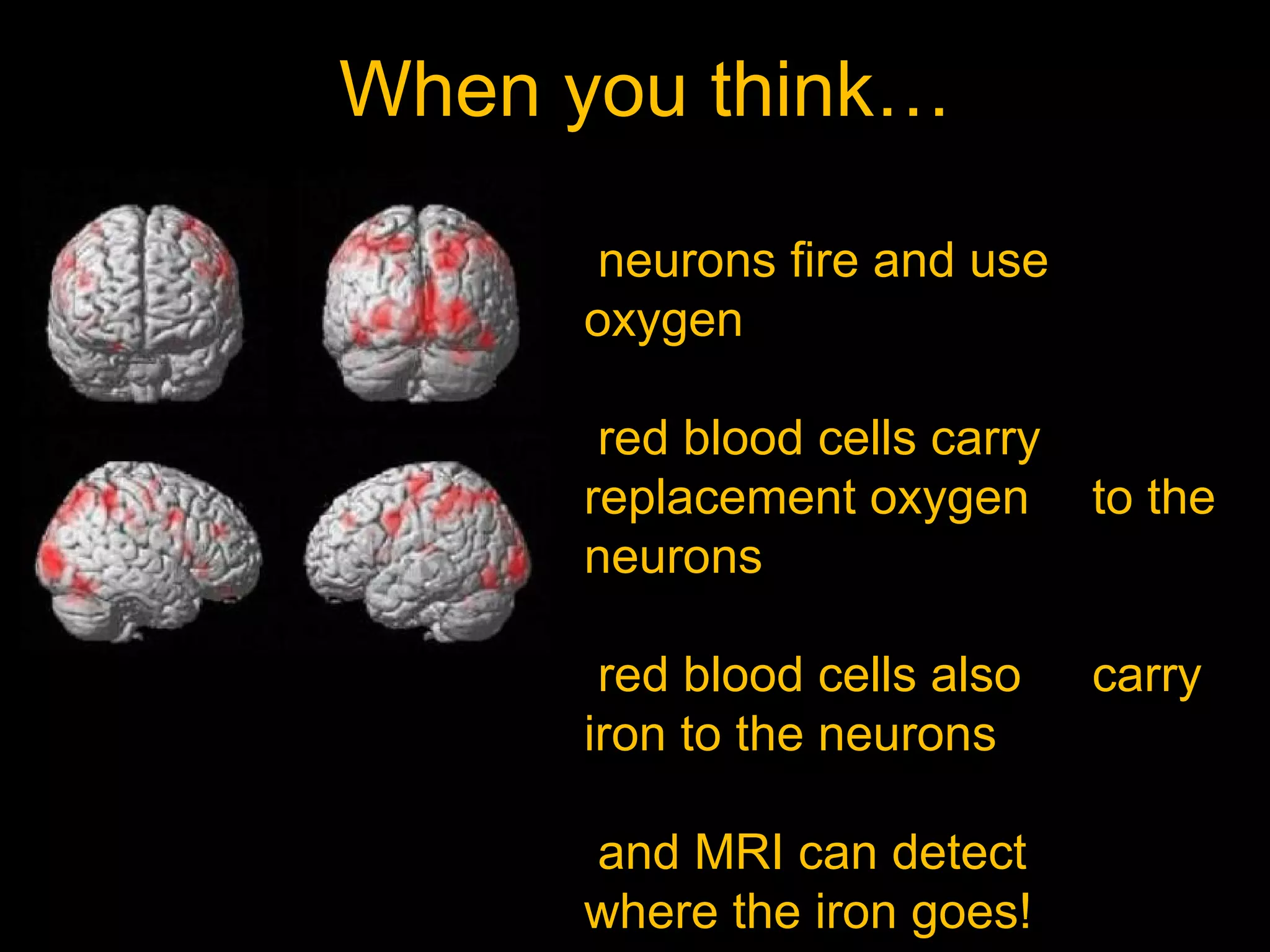 MRI explained | PPT