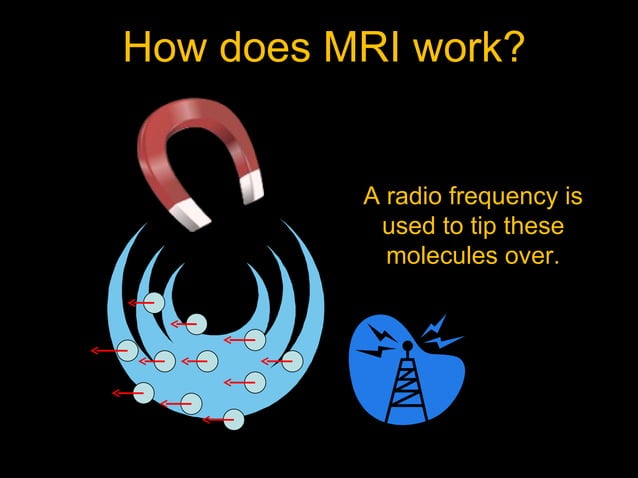 MRI explained | PPT | Blood Disorders | Diseases and Conditions