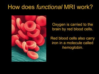 MRI explained | PPT