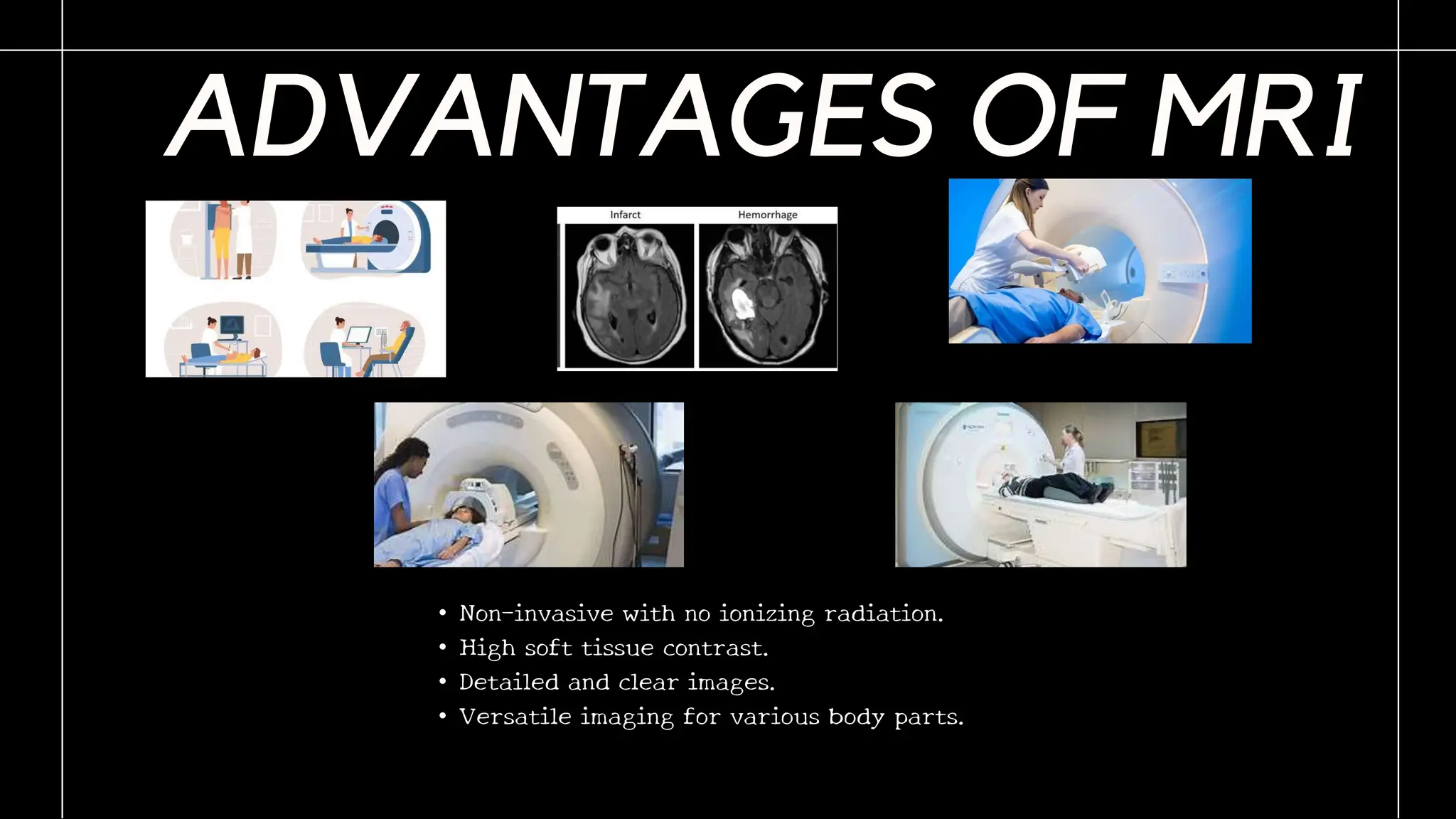 "Understanding MRI Scans: How They Work – A Guide by Sanjivini ...